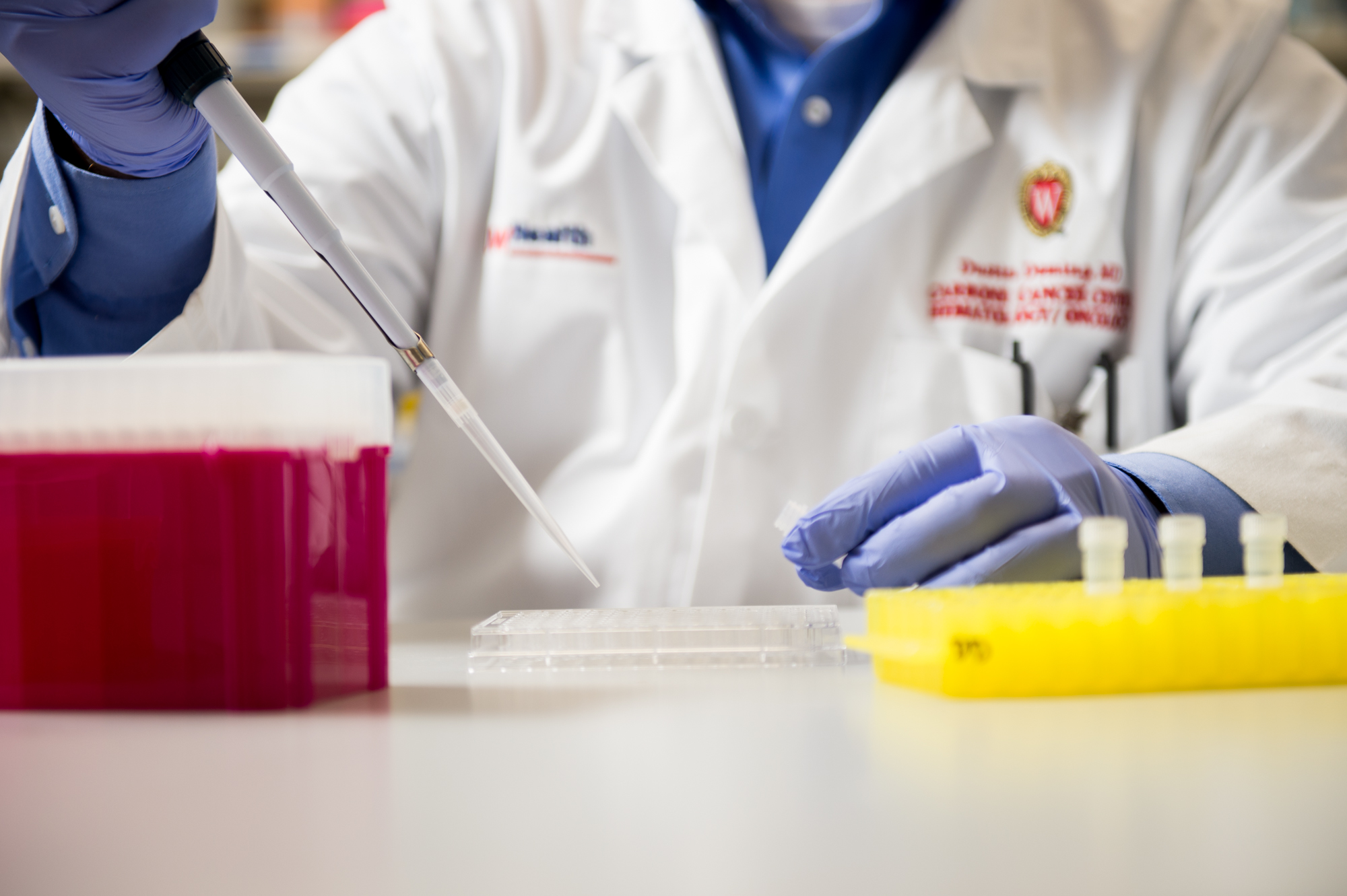 UW-Madison study finds protein that improves immune response in colon ...